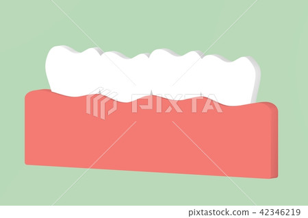 crowding teeth ( malocclusion ) - Stock Illustration [42346219] - PIXTA