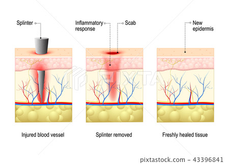 Skin Scab Diagram