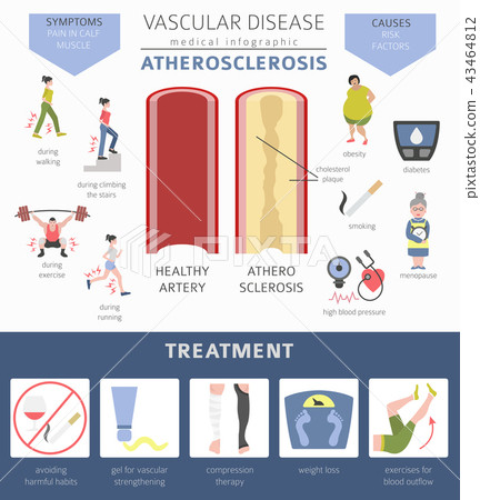 Vascular diseases. Atherosclerosis infographic-插圖素材 [43464812] - PIXTA圖庫