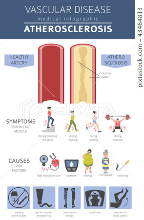 Vascular diseases. Atherosclerosis infographic - Stock Illustration ...