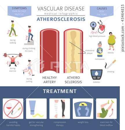 Vascular diseases. Atherosclerosis infographic-插圖素材 [43464815] - PIXTA圖庫