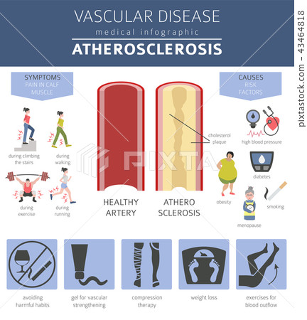 Vascular diseases. Atherosclerosis infographic - Stock Illustration ...
