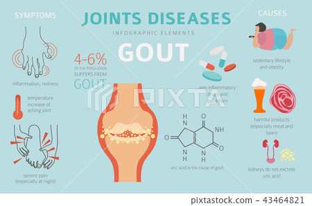 Joints diseases. Gout infographic - Stock Illustration [43464821] - PIXTA