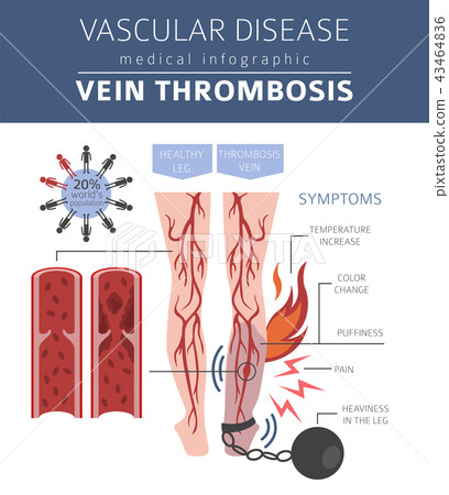Vascular diseases. Vein thrombosis infographic - Stock Illustration ...
