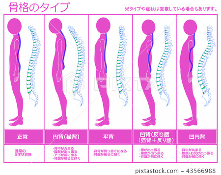 Skeletal Type Spine (Pink) - Stock Illustration [43566988] - PIXTA