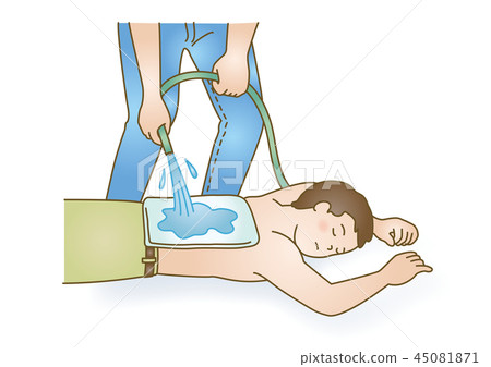 First aid illustration 48: Burn - Stock Illustration [45081871] - PIXTA