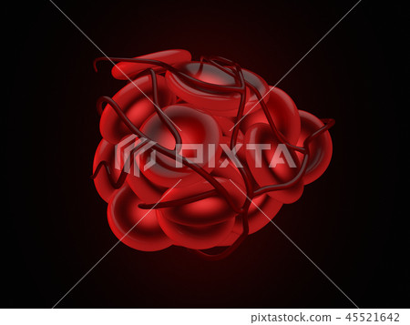 3d illustration of a blood clot, thrombus - Stock Illustration ...