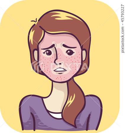 Symptom Severe Blushing Illustration-插圖素材 [45793227] - PIXTA圖庫