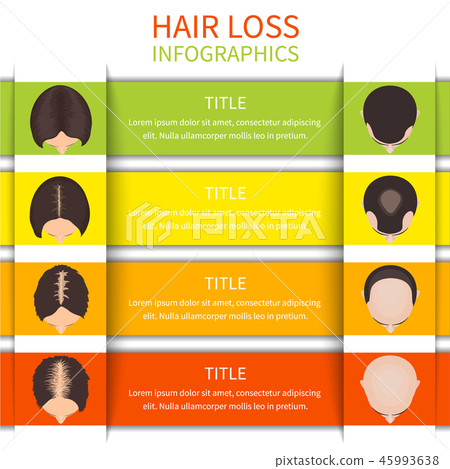 Hair loss infographic template - Stock Illustration [45993638] - PIXTA