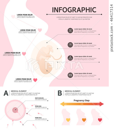 Pregnancy info graphic - Stock Illustration [46417314] - PIXTA