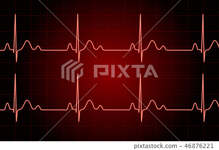 ECG image - Stock Illustration [46876221] - PIXTA