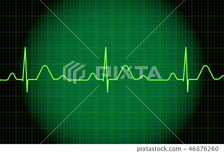 ECG image - Stock Illustration [46876260] - PIXTA