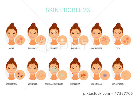 Skin problems vector - Stock Illustration [47357766] - PIXTA