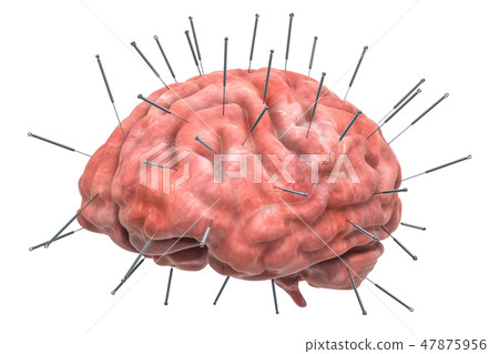 Human brain with acupuncture needles - Stock Illustration [47875956 ...