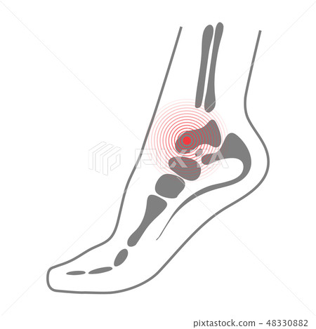 Foot Sole With Bones Illustration For... - Stock Illustration [48330882 ...