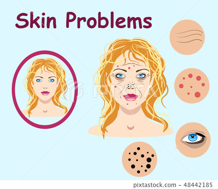Female face skin problems. Vector illustration - Stock Illustration ...