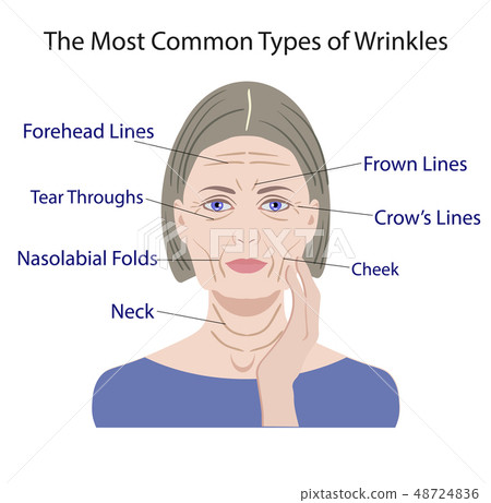 Common Types of Facial Wrinkles. cosmetic surgery. - Stock Illustration ...