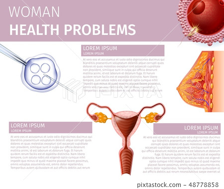 Woman Health Problem Anatomical Medical Aid Banner - Stock Illustration ...