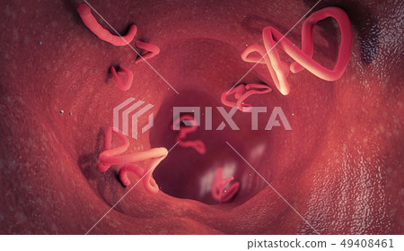Tapeworm infestation in a human intestine - Stock Illustration ...