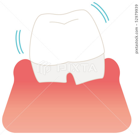 Rag tooth illustration - Stock Illustration [52979939] - PIXTA
