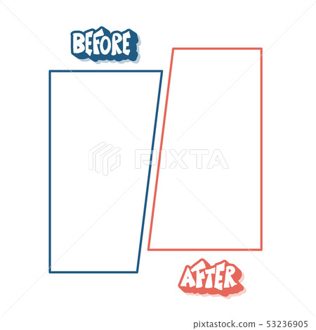 Before and after template. Vector screen elements. - Stock Illustration [53236905] - PIXTA