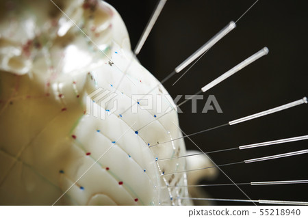 Route anal anal fistula model acupuncture... - Stock Photo [55218940 ...