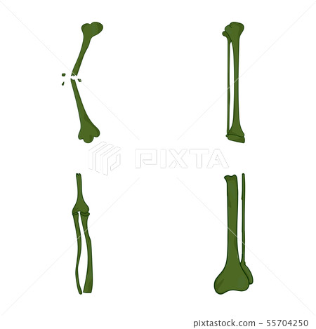 Hand drawn realistic human bones. Vector... - Stock Illustration ...