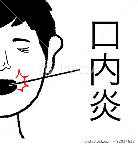 stomatitis - Stock Illustration [58034632] - PIXTA