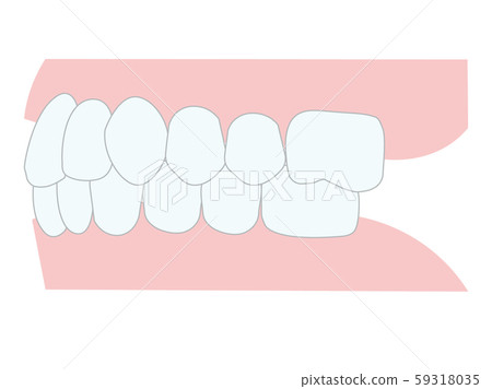 Normal occlusion Teeth alignment - Stock Illustration [59318035] - PIXTA