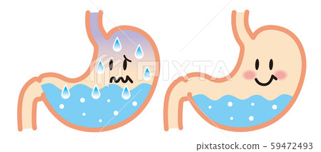 Stomach excessive acidity illustration - Stock Illustration [59472493 ...
