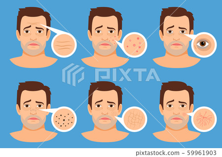 Man skin problems illustration - Stock Illustration [59961903] - PIXTA