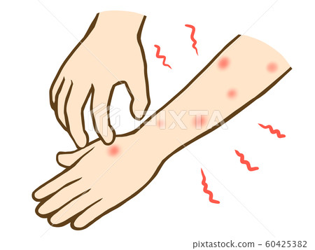 Arm bites - Stock Illustration [60425382] - PIXTA
