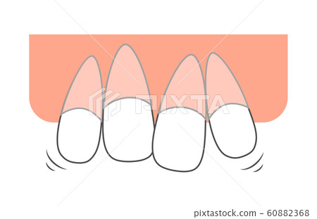 Rattle teeth alignment front tooth orthodontics - Stock Illustration ...