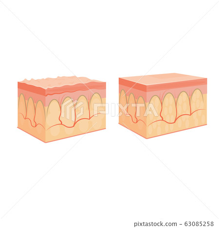 wrinkle and normal skin cross-section of human... - Stock Illustration ...