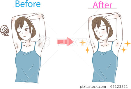 A woman who cares about waste hair Before After - Stock Illustration ...