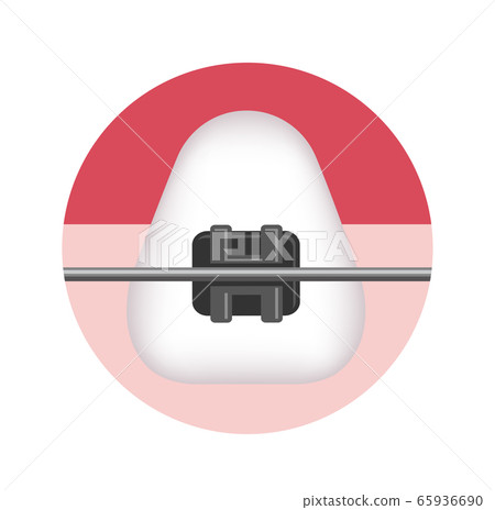 Orthodontics, orthodontics, vector illustration - Stock Illustration ...
