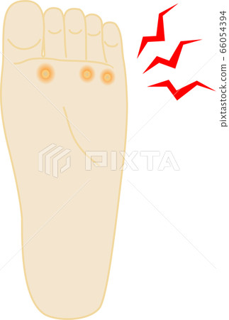Illustration of a fish eye hurting foot - Stock Illustration [66054394 ...