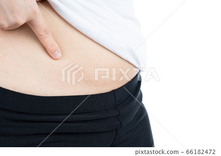 Appendicitis Scar Belly Button