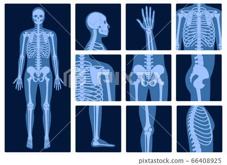 Skeleton x ray - Stock Illustration [66408925] - PIXTA