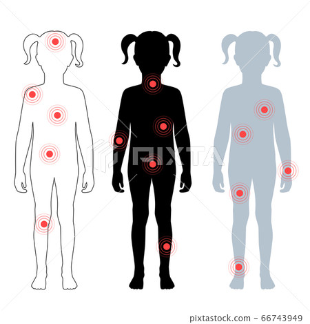 Pain in human body - Stock Illustration [66743949] - PIXTA