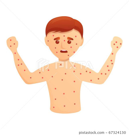 Boy skin rash icon, cartoon style - Stock Illustration [67324130] - PIXTA