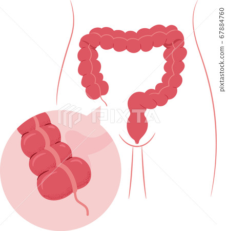 Appendix Body Organ Illustration - Stock Illustration [67884760] - PIXTA