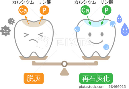 Tooth decalcification and remineralization - Stock Illustration ...