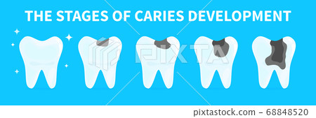 Dental Caries Cartoon Premium Vector | Dental Problem And Tooth