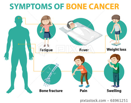 Medical infographic of bone cancer symptoms - Stock Illustration ...