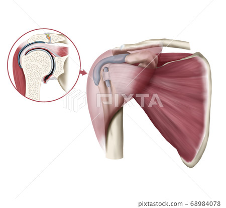 Subacromial bursa - Stock Illustration [68984078] - PIXTA