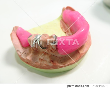 Mandibular denture metal frame and wax ring - Stock Photo [69044022 ...