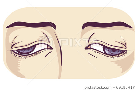 Eye Muscles Weakness Control Illustration - Stock Illustration ...