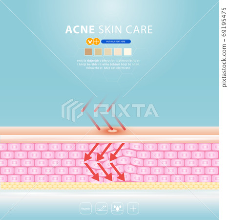 acne skin spot pimple problem vector design. - Stock Illustration ...