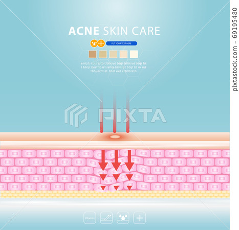 acne skin spot pimple problem vector design. - Stock Illustration ...